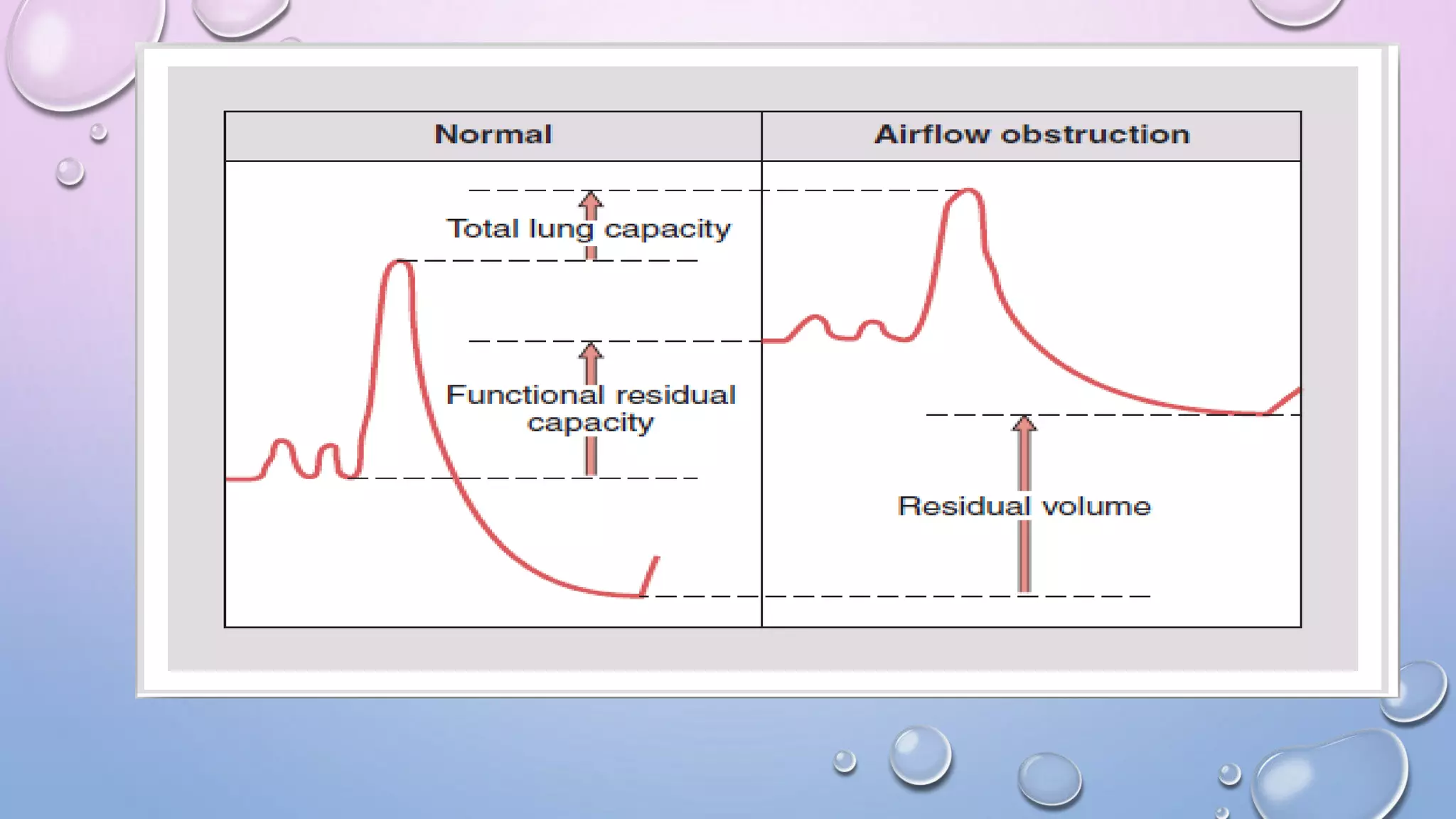 Obstructive and restrictive of lung disease | PPTX