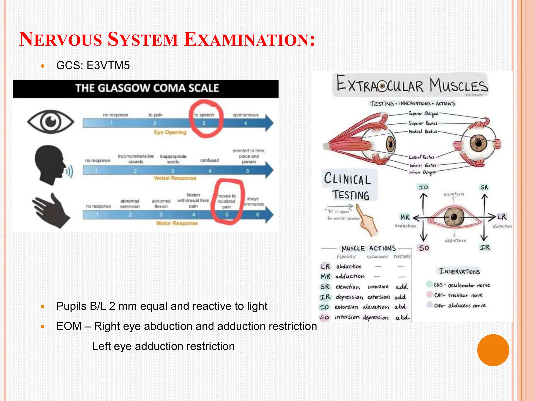 Clinical presentation on posterior circulation stroke | PPTX | Brain ...