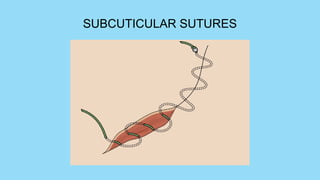 Workshop on Basic Principles of Sutures , Wound.pptx
