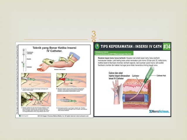 WORKSHOP Pencegahan dan pengendalian infeksi.pptx