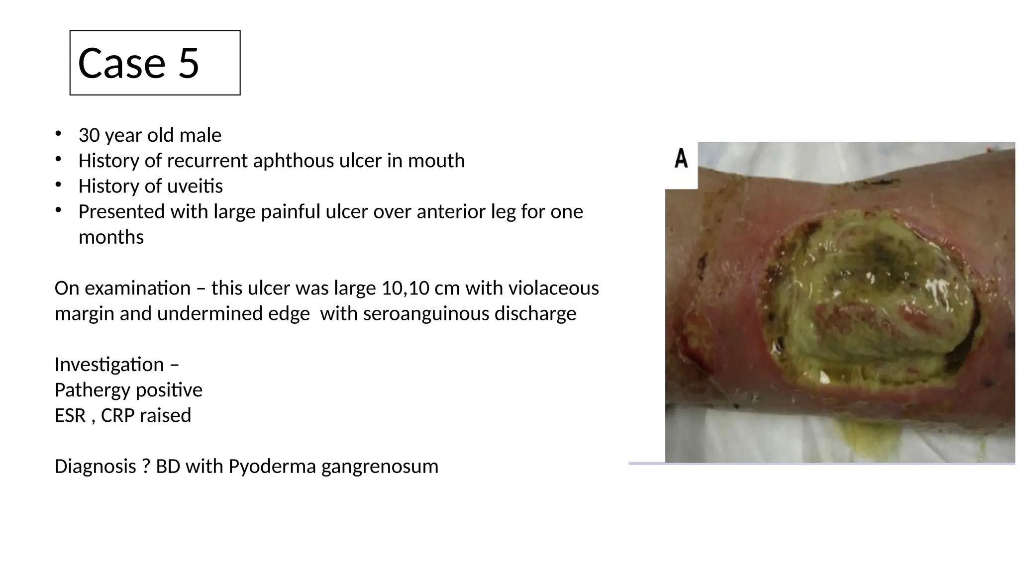 non-healing ulcer work up powerpoint presentation | PPTX