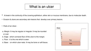 non-healing ulcer work up powerpoint presentation | PPTX