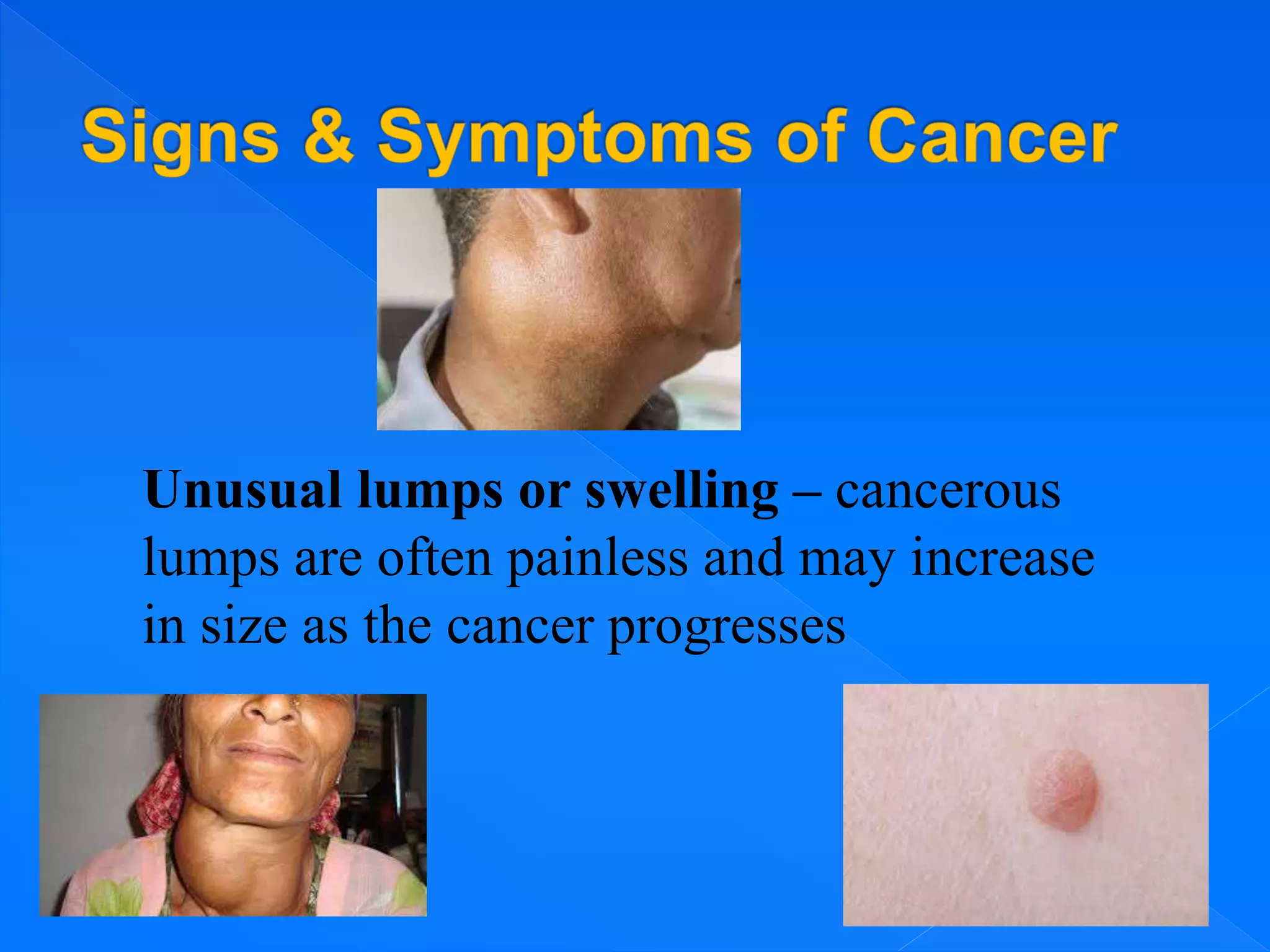 World cancer day presentation | PPTX
