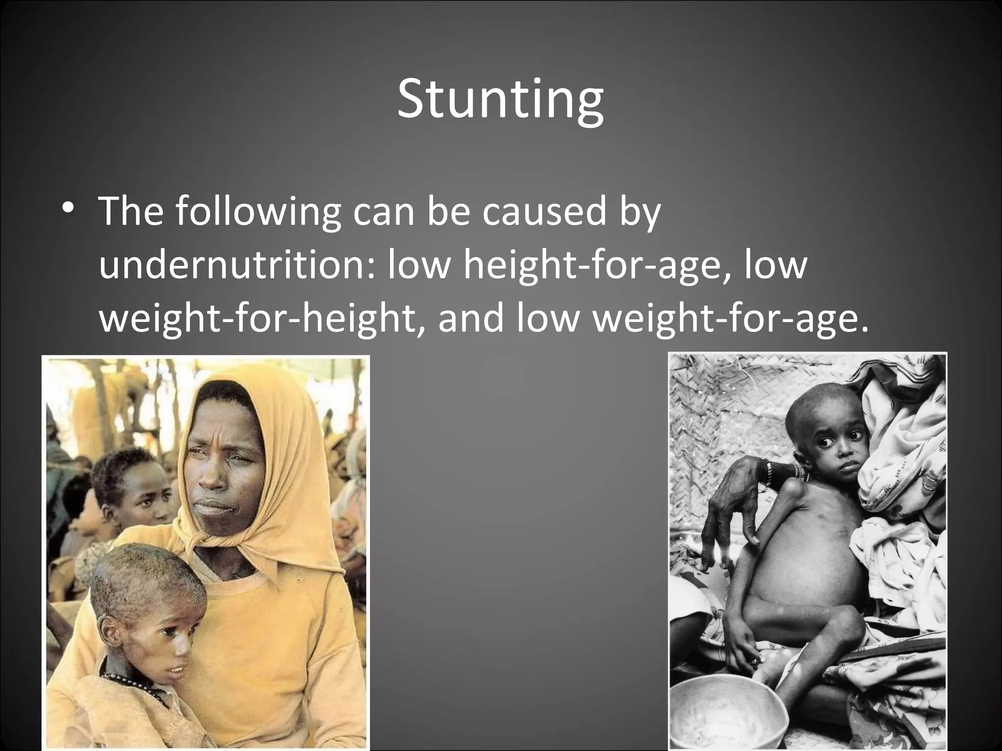 Effects of Child Undernutrition in the Developing World | PPT