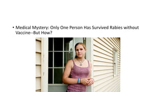 Rabies- World rabies day | PPTX