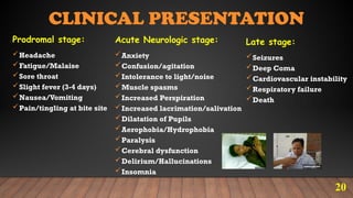 World Rabies day 2024-1.pptx epidemiology,symptoms and management | PPTX