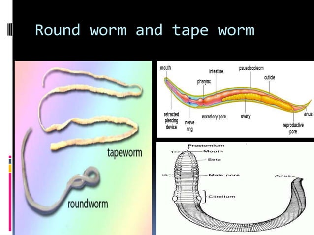 Worm infestation | PPTX | Infectious Diseases | Diseases and Conditions