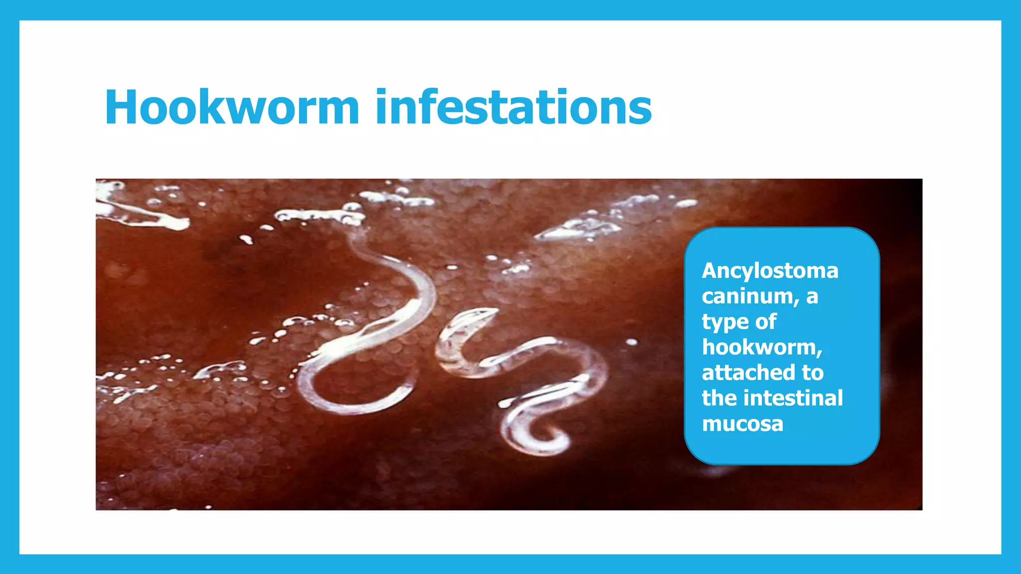 Worm infestation | PDF