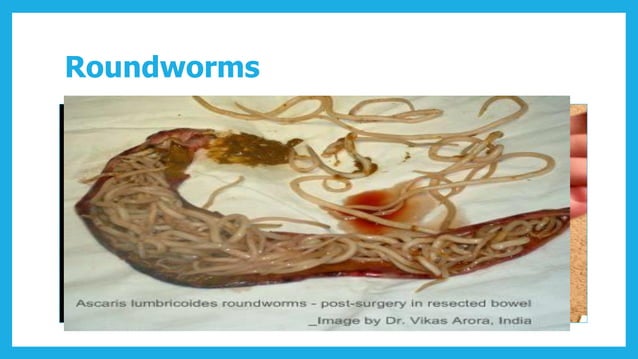Worm infestation | PDF