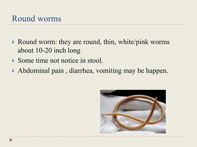 Worm infestation.. | PPTX