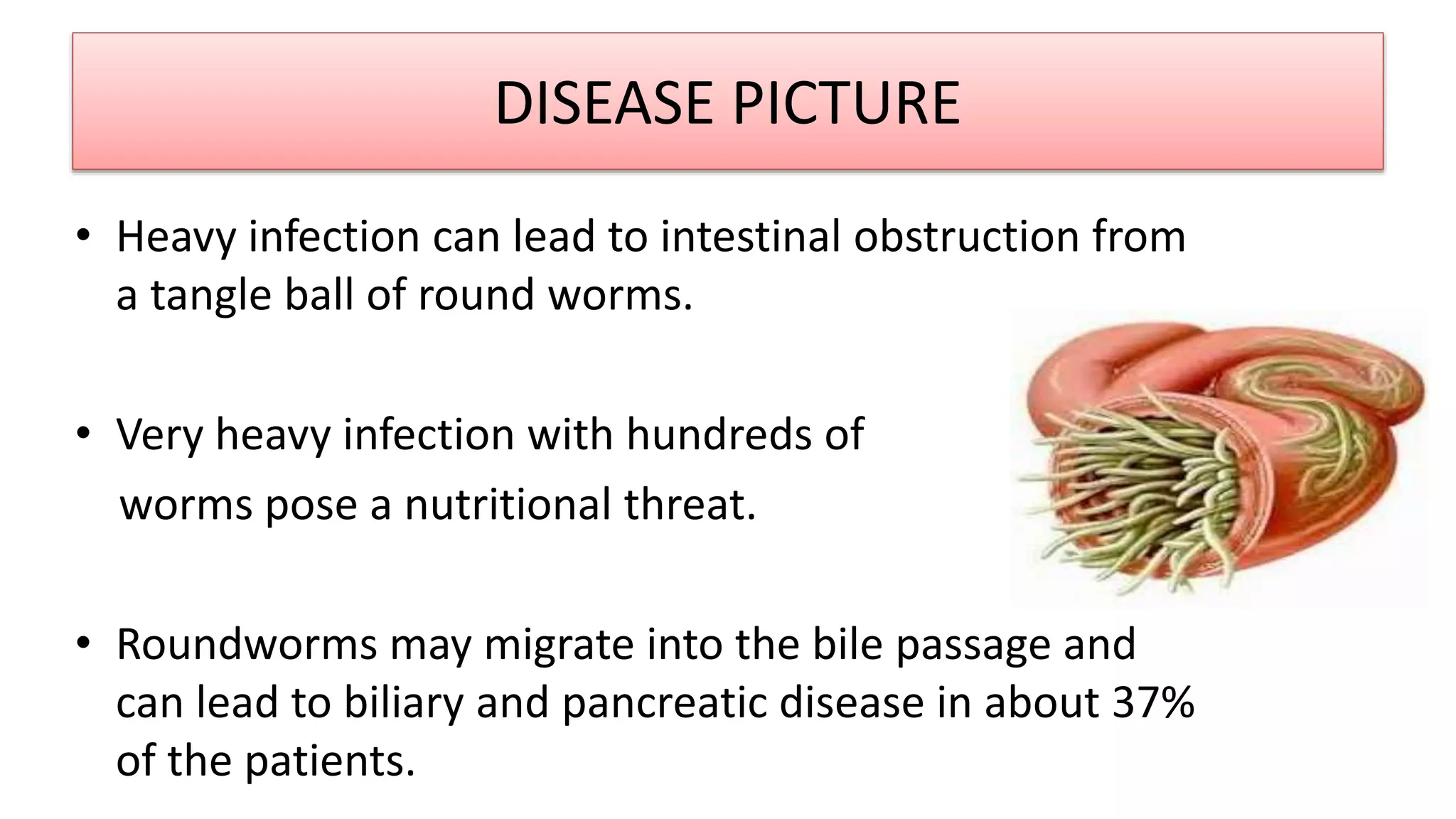 Worm infestation | PPTX