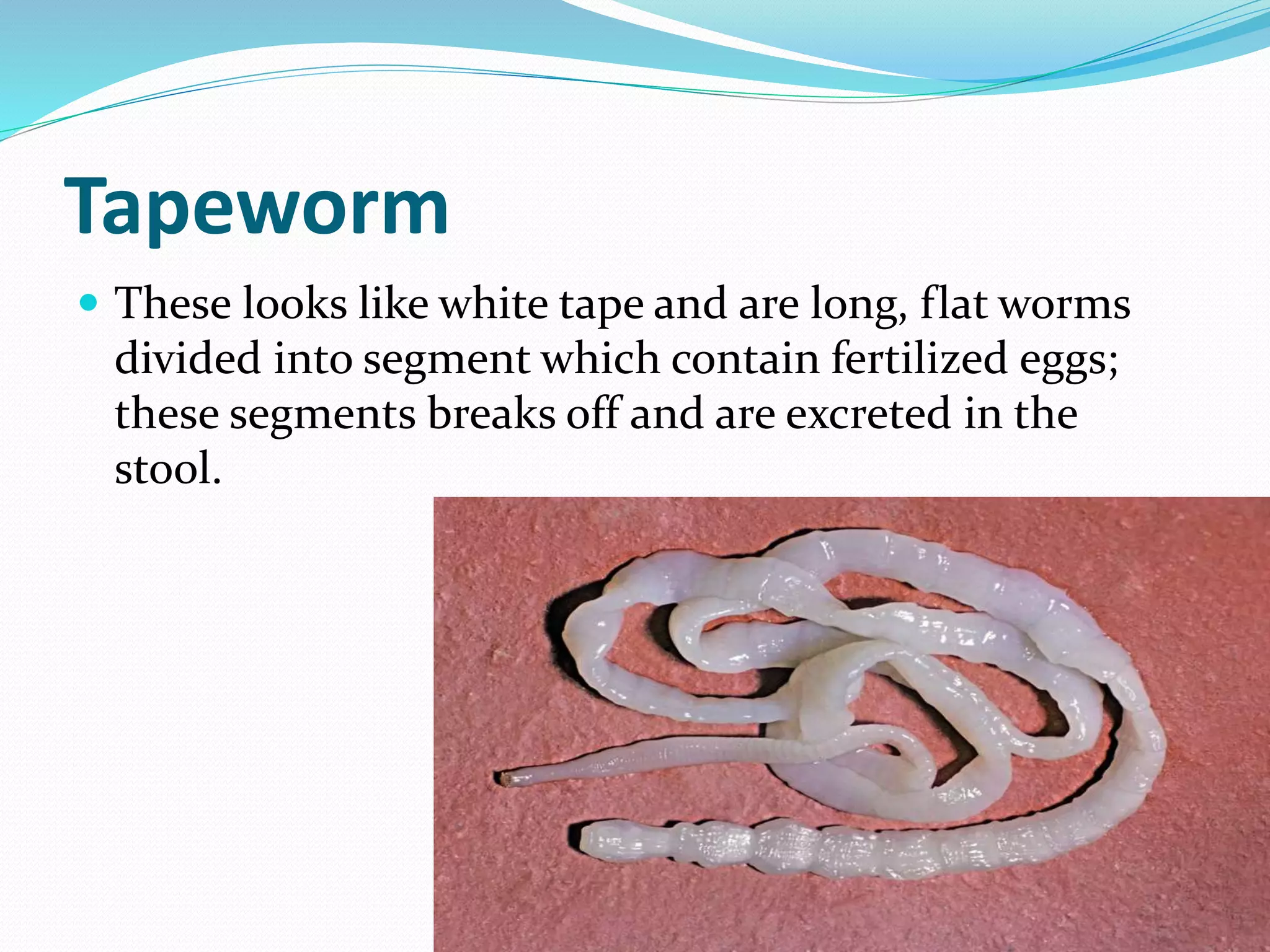 Worm infestation.pptx