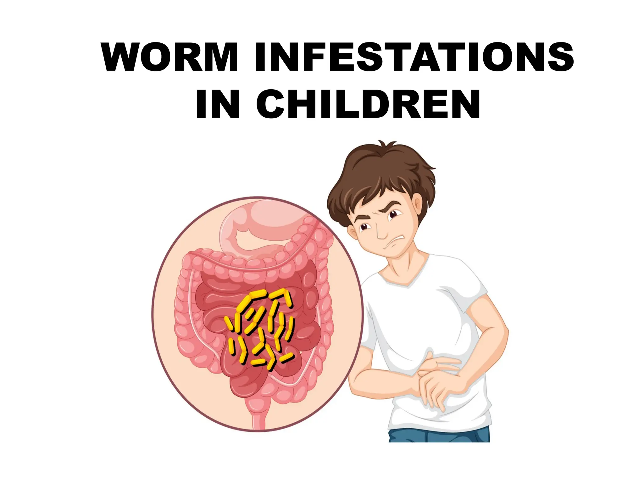 S.Y. G.N.M. CHILD HEALTH NURSING-WORM INFESTATION.pptx