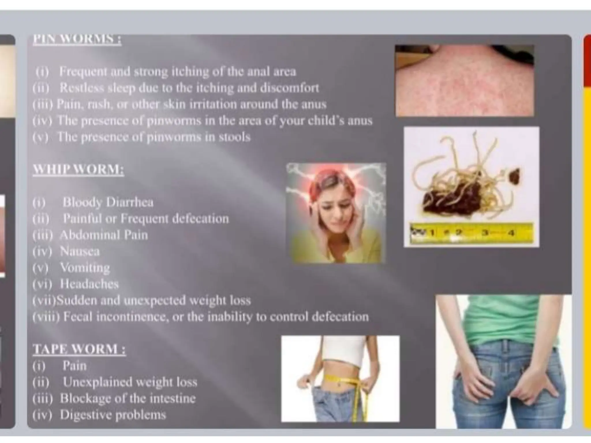 worm infestation | PPTX | Infectious Diseases | Diseases and Conditions