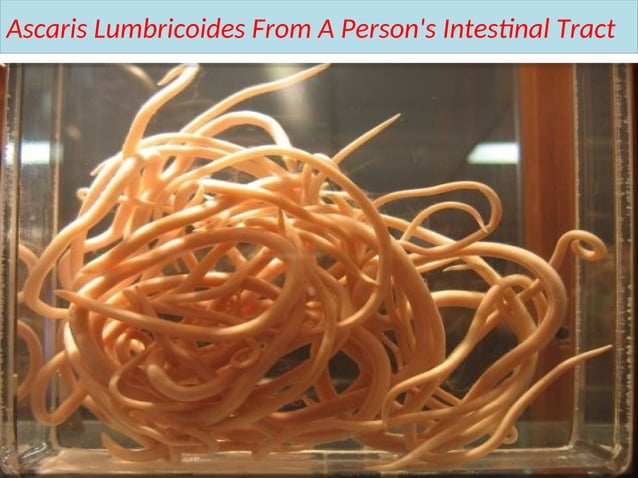 WORM INFESTATIONS 2017 in health nursing .ppt