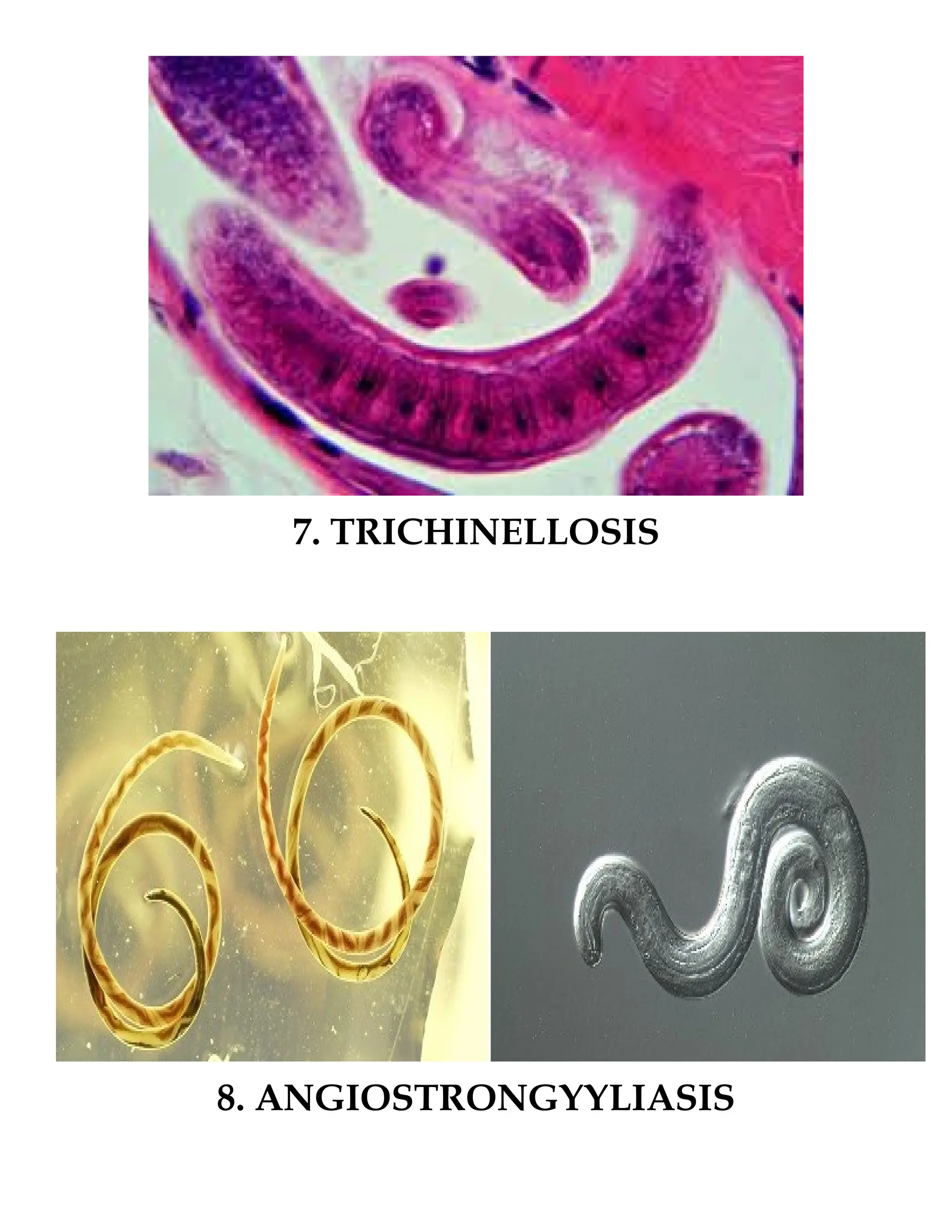 The Round WORMS that can be found in human bodies.docx