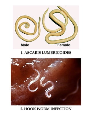 The Round WORMS that can be found in human bodies.docx