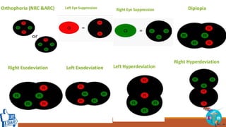 Worth 4 dot test | PPTX