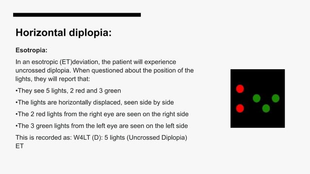 worth 4 dot test.pptx | Eye and Vision Conditions | Diseases and Conditions