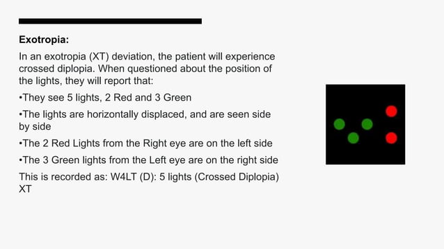 worth 4 dot test.pptx | Eye and Vision Conditions | Diseases and Conditions