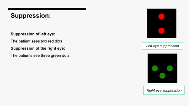 worth 4 dot test.pptx | Eye and Vision Conditions | Diseases and Conditions