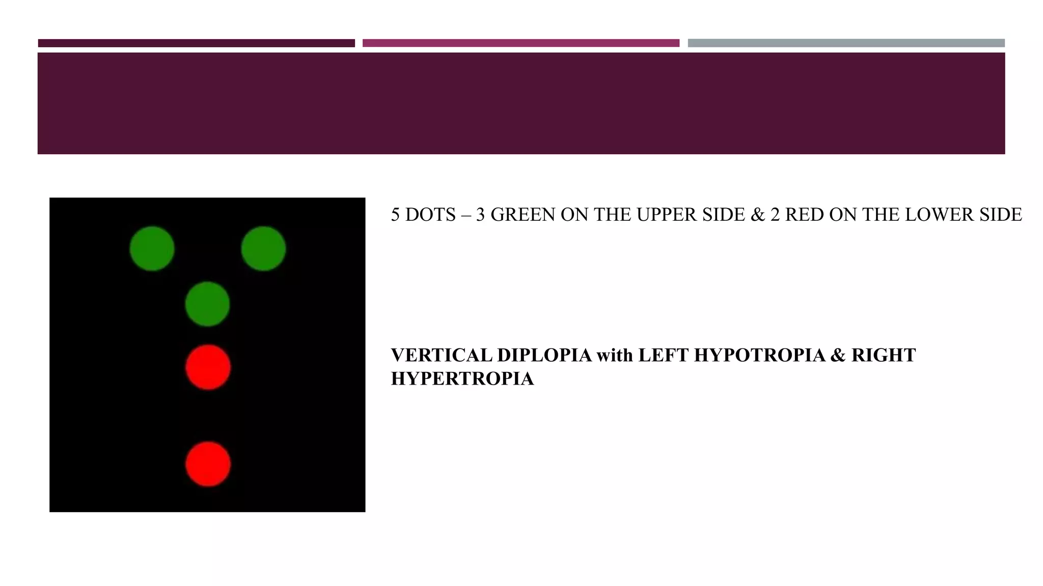 WORTH FOUR DOT TEST.pptx