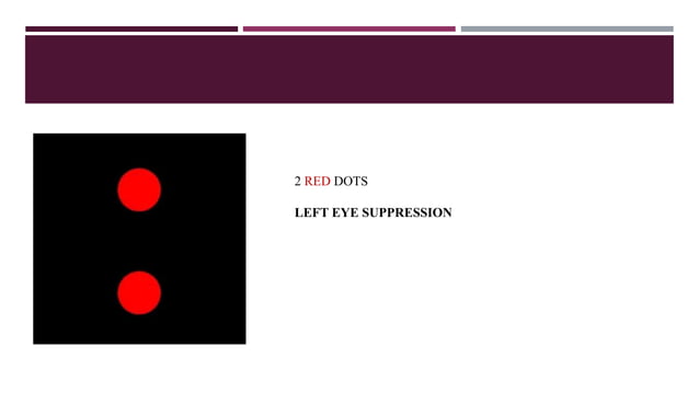 WORTH FOUR DOT TEST.pptx | Eye and Vision Conditions | Diseases and ...