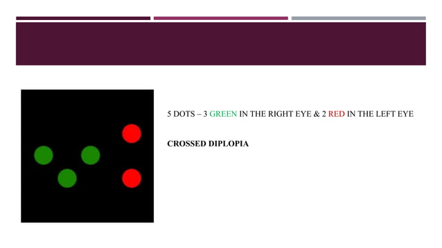 WORTH FOUR DOT TEST.pptx | Eye and Vision Conditions | Diseases and ...