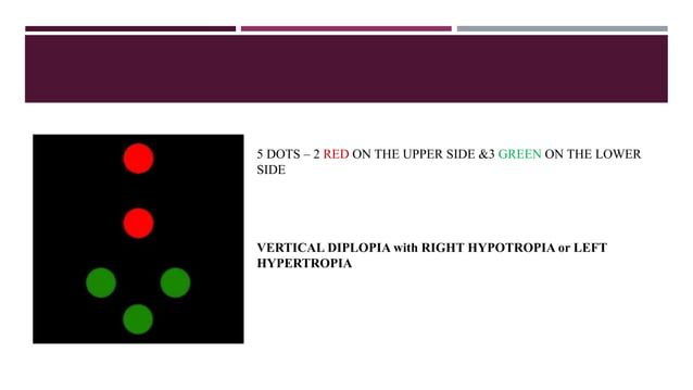 WORTH FOUR DOT TEST.pptx | Eye and Vision Conditions | Diseases and ...