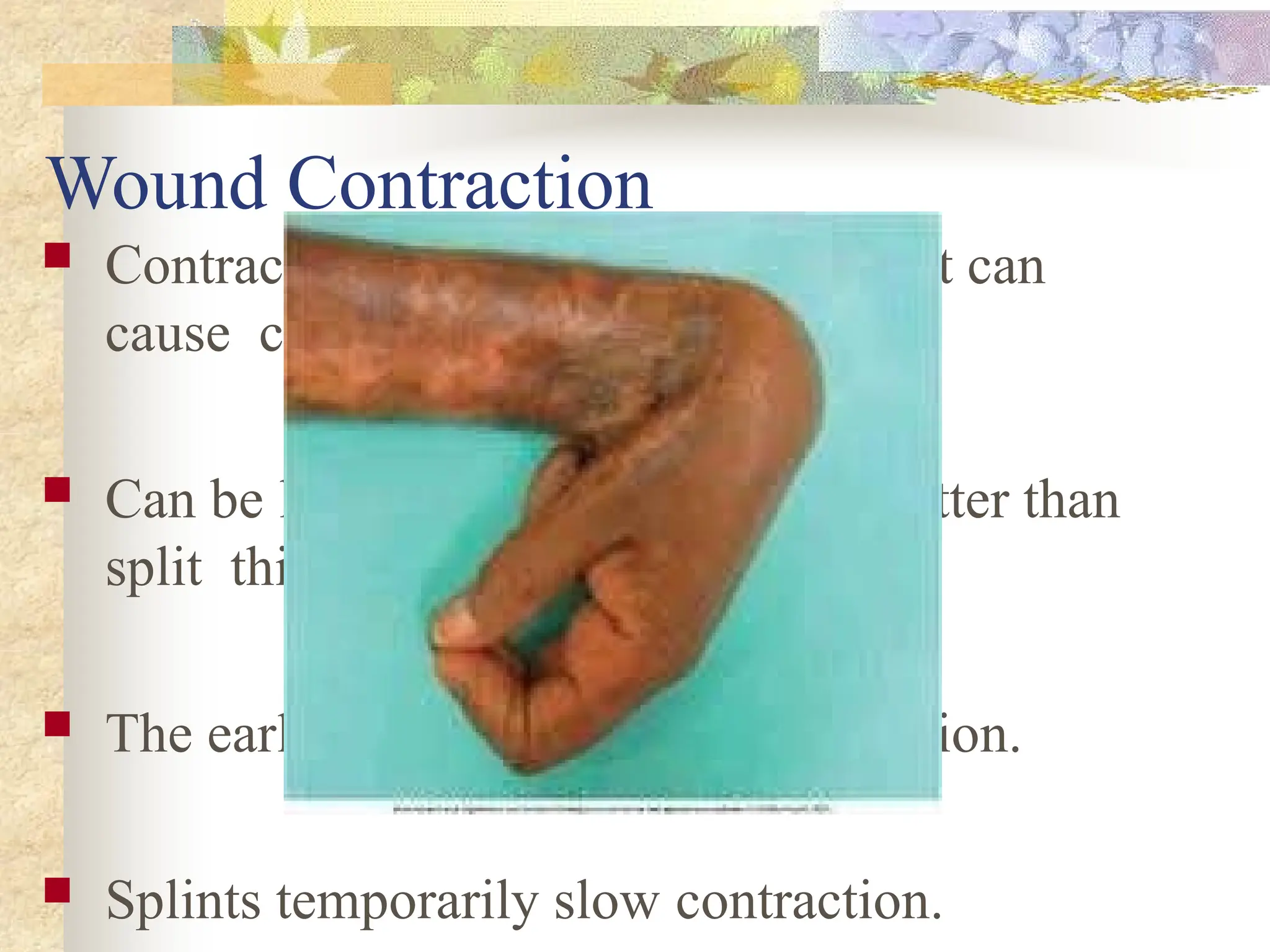 wound classification related neurosurgery | PPTX