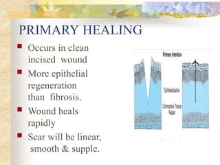 wound classification related neurosurgery | PPTX