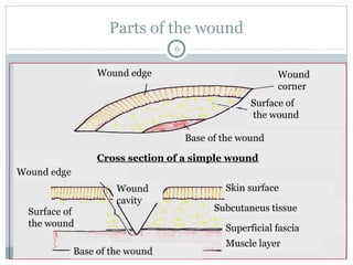 Wound: classification, healing and principle of management | PPT