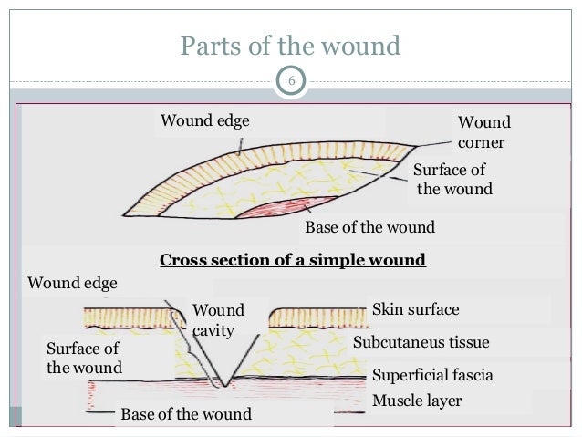 Wound: classification, healing and principle of management