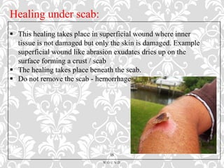 Wound | PPTX | First Aid | Injuries