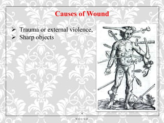 Wound | PPTX | First Aid | Injuries