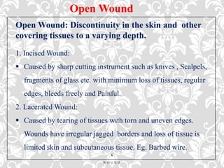 Wound | PPTX | First Aid | Injuries