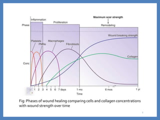 WOUND AND RECENT MANAGEMENT TRENDS | PPT