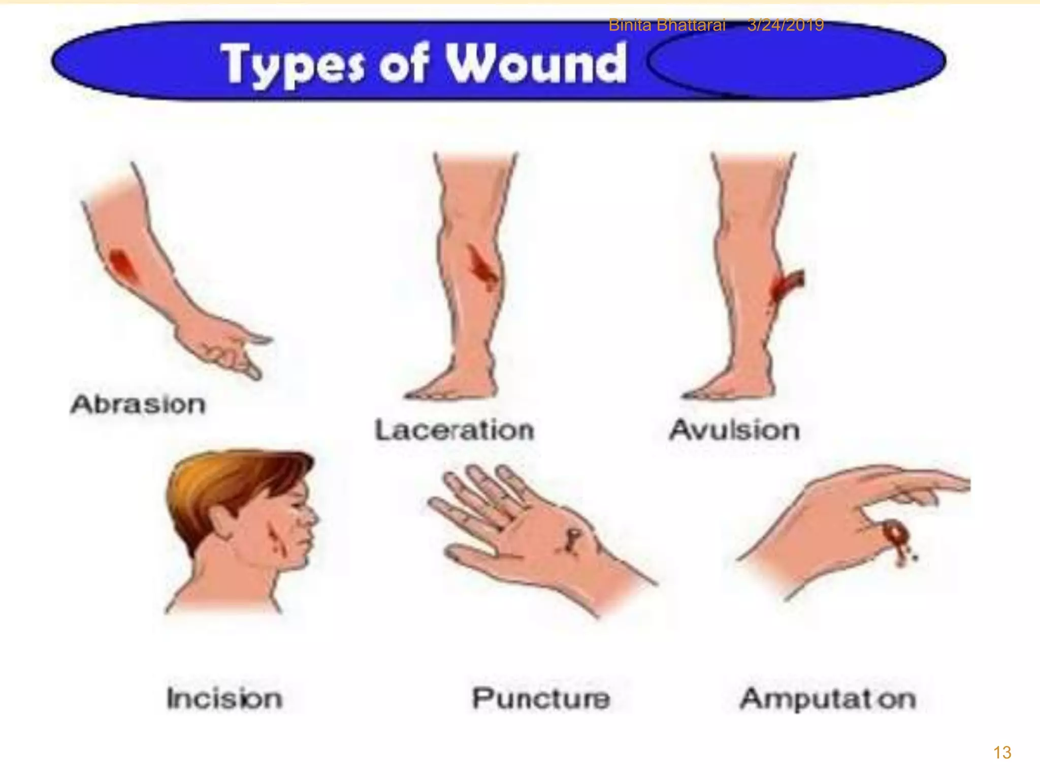 First aid management of Wound | PPTX