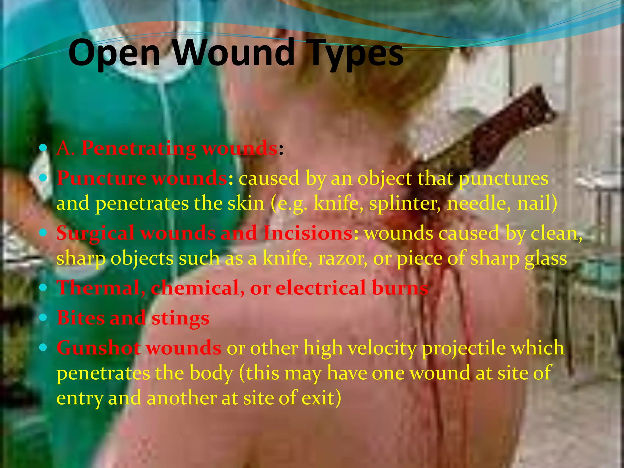 Wound | PPTX