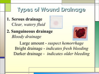Serosanguineous Drainage Color