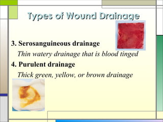 Types Of Wound Drainage