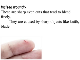 wound.pptx