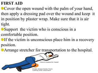 wound.pptx