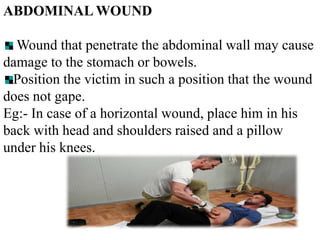 wound.pptx