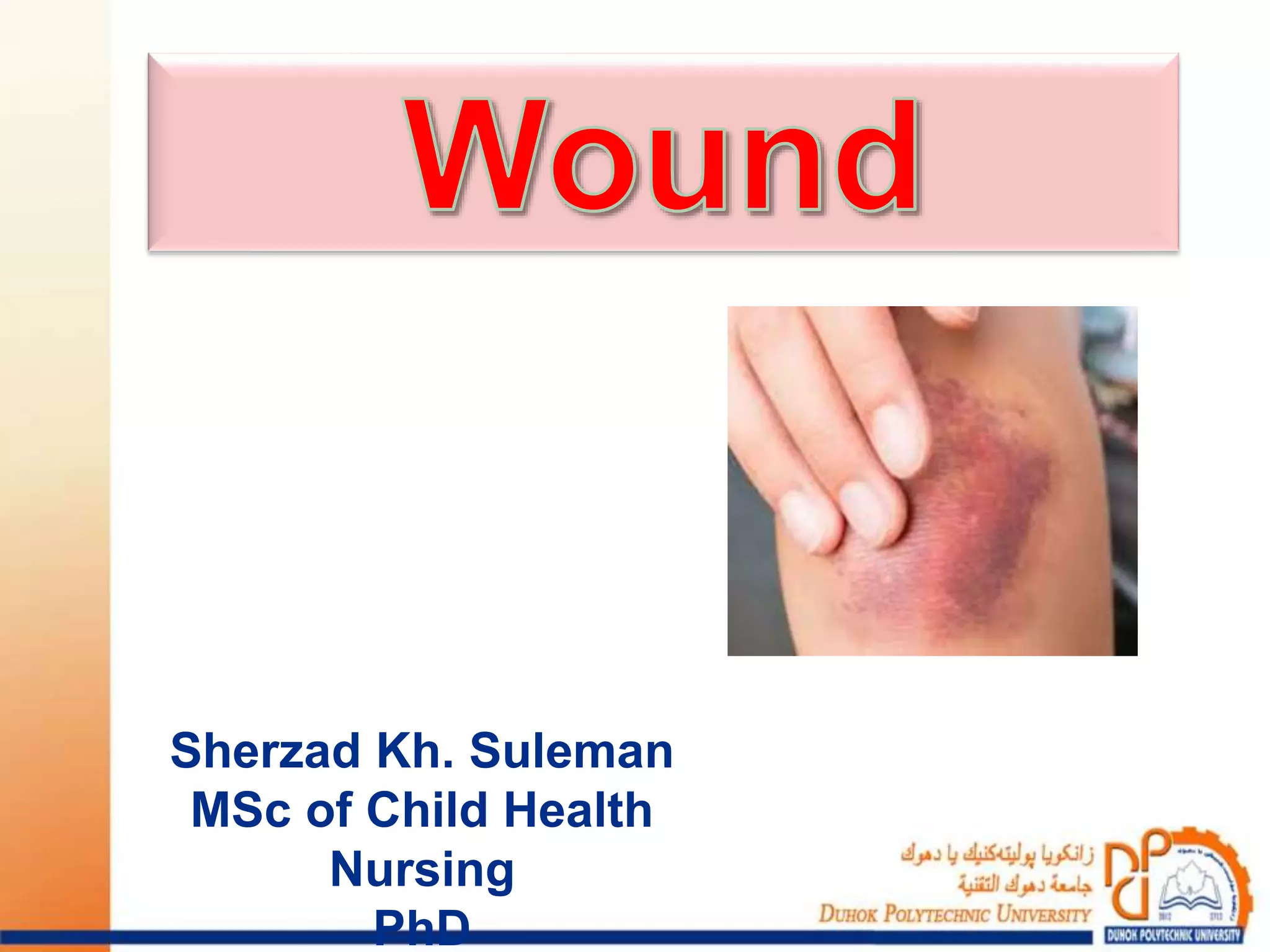 Wound.ppt