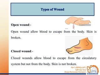 Wound.ppt