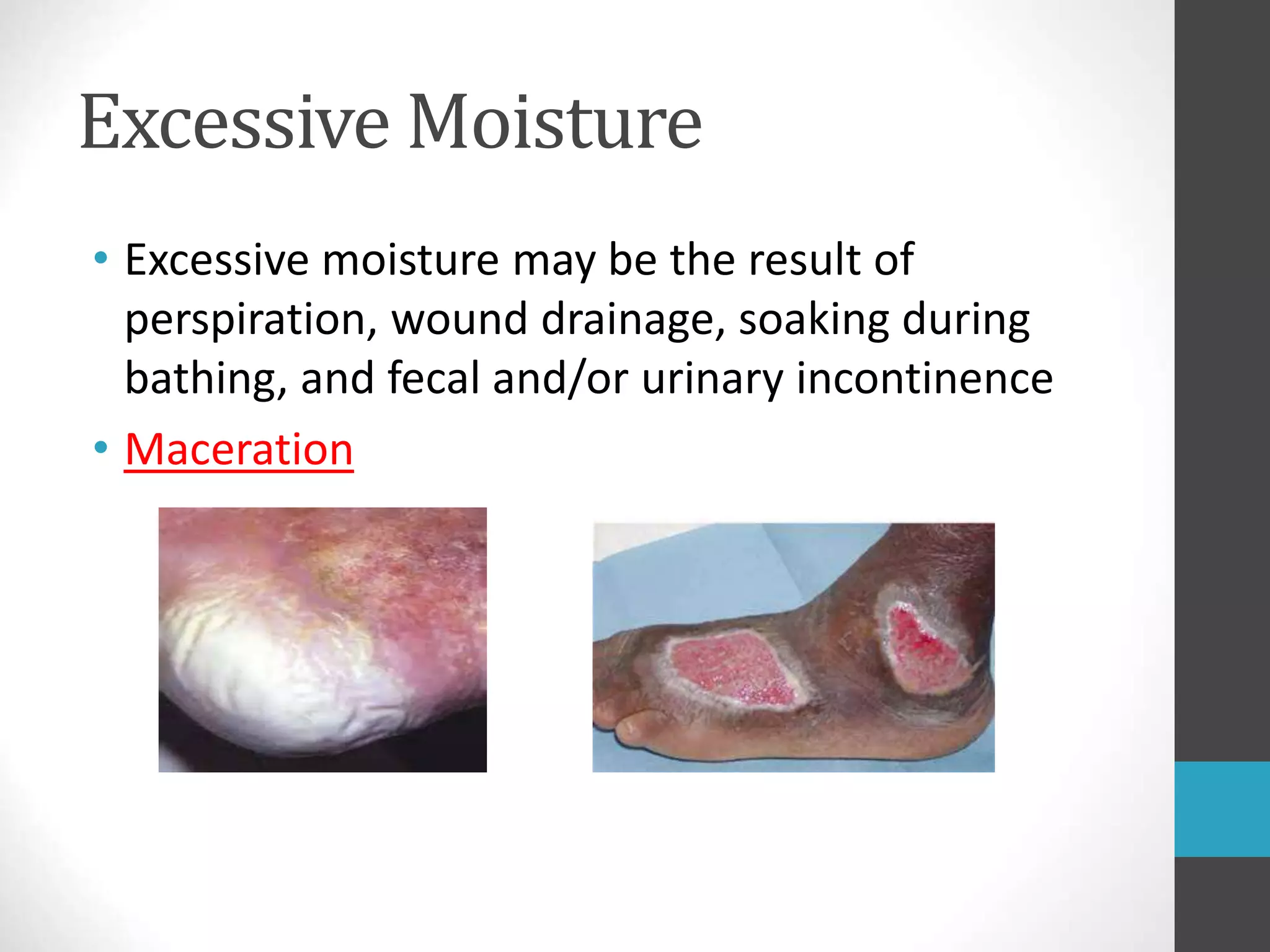 wound-care.ppt