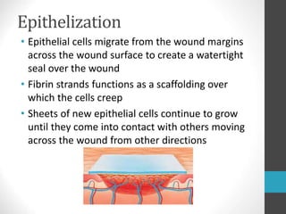 wound-care.ppt