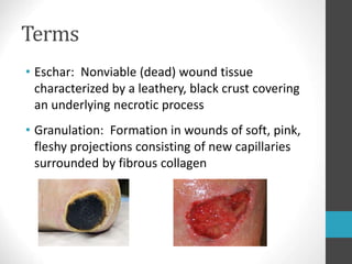 wound-care.ppt