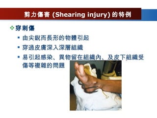 Wound Cd Packing Immobilization | PPT